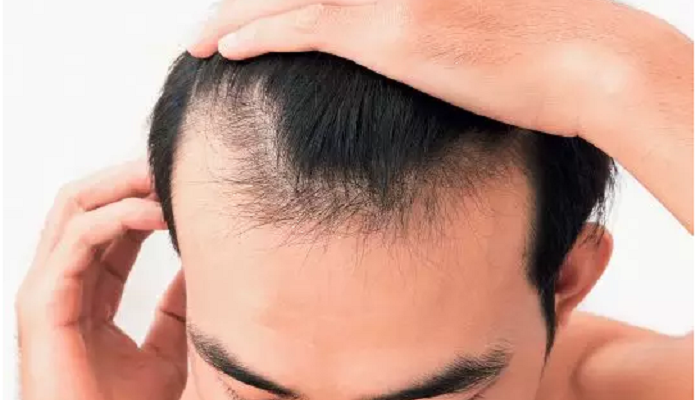 200 مليون صيني يفقد شعره مبكرا.. وزيادة 136٪ في مبيعات الشامبو