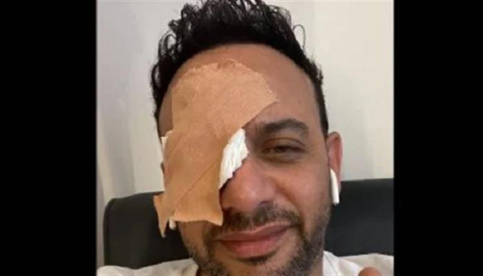 إصابة مصطفى قمر بـ"ضربة" من خالد سرحان في "حريم كريم 2"