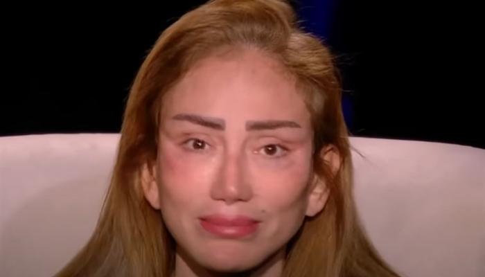 ريهام سعيد باكية: أضع 13 كيلو مكياج لإخفاء آثار عملية التجميل الفاشلة