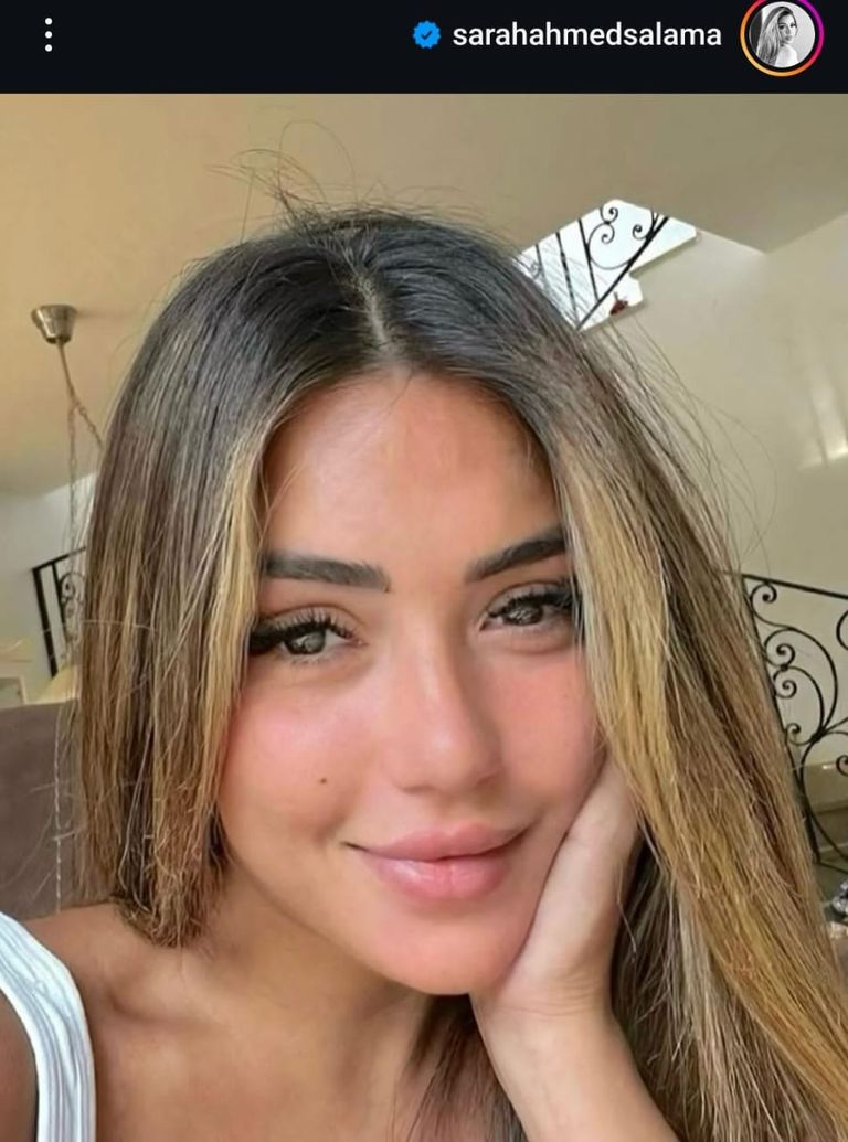 سارة سلامة ترد على شائعات عمليات التجميل بصورة جديدة